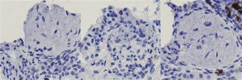 Deep Learning For Low Contrast Objects Quantacell