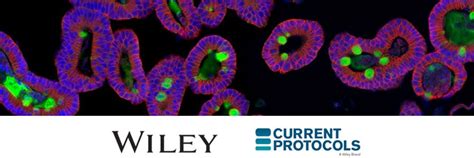 Overview Intestinal Organoids Organoid Research Areas Of Interest