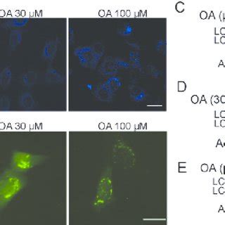 Autophagy Induced By OA In HepG2 Cells Was ROS Dependent A B HepG2