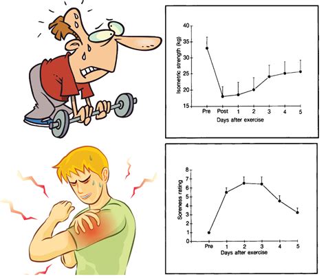 Eccentric Exercise Induced Muscle Damage And The “repeated Bout Effect