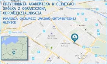 Ortopeda Gliwice Na NFZ Najszybszy Termin Na NFZ