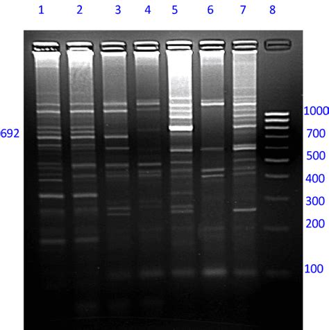 Dna Fragment Analysis Gel Electrophoresis Results Png Free Download