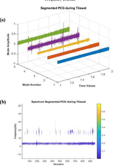 Figure 7 From Classification Of Phonocardiography Based Heart Auscultations While Listening To