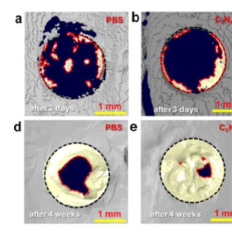C3n4 Sheets For The Enhancement In Repairing Cranial Bone Defect Under Download Scientific