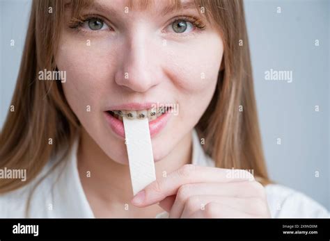 Young Woman With Metal Braces On Her Teeth Is Chewing Gum The Girl Is