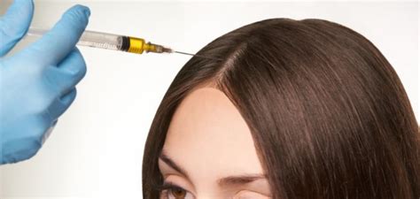 تكلفة زراعة الشعر بالخلايا الجذعية Clinicexpert خدمات زراعة الشعر