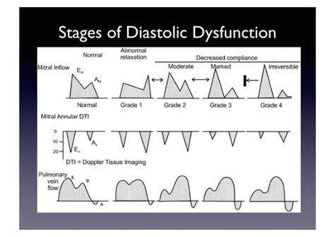 Echocardiographic Evaluation Of Lv Diastolic Function Pdf