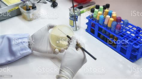 실험실에서 병원 균의 박테리아 문화와 약물 저항에 종사 하는 손 의료 기술자에 가까이 박테리아 식별 Stem 주제에 대한 스톡