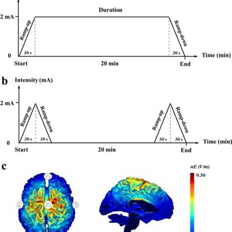 High Definition Transcranial Direct Current Stimulation A Tdcs
