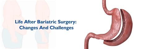 Life After Bariatric Surgery