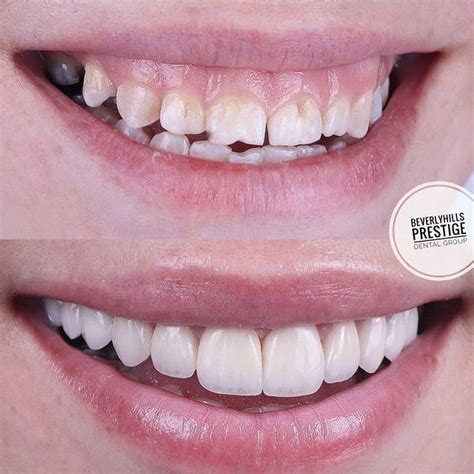 Smile Gallery Beverly Hills Prestige Dental Group Los Angeles California