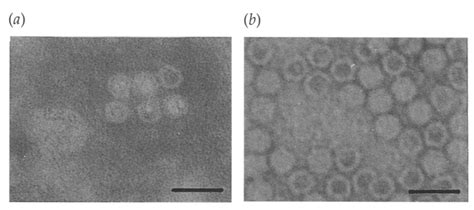 Electron Micrograph Of Recombinant Vlps A And Csci Gradientpurified Download Scientific
