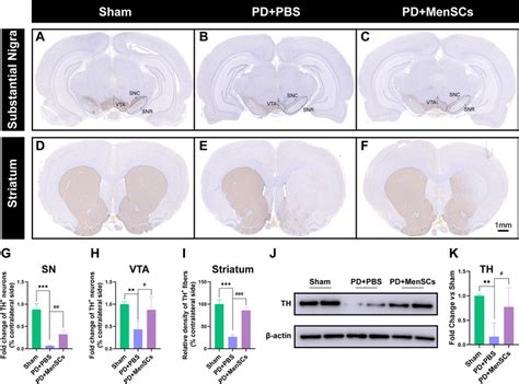 The Expression Of Th In The Sn Vta And Striatum Regions Ac The