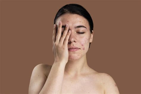 Skin Diseases Homeopathic Clinic