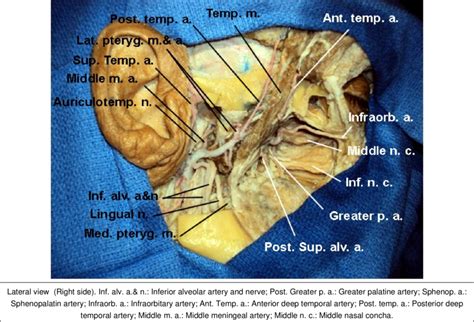 A Cadaveric Dissection Ma Lateral Variant Download Scientific Diagram
