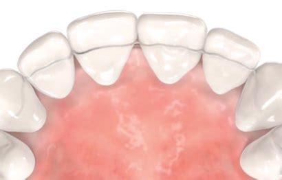 Memotain Uportho Com 2025