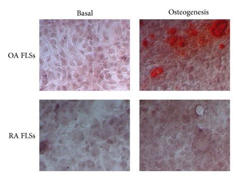 Alizarin Red Staining And Analysis A Alizarin Red Staining Of Download Scientific Diagram