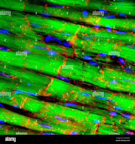 Heart Tissue Fluorescence Deconvolution Micrograph Of A Section