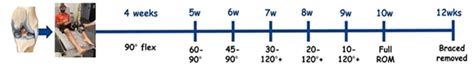 Acl Healing And The “cross Bracing Protocol” Physiotherapy Manly