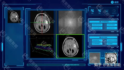 医学影像人工智能科研创新平台 知乎