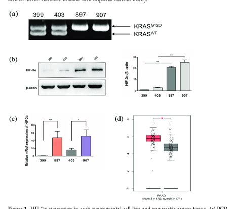 Hif 2α Expression In Each Experimental Cell Line And Pancreatic Cancer