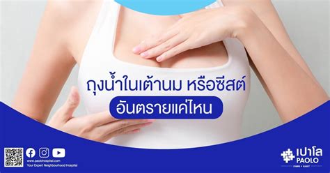 ถุงน้ำในเต้านม หรือซีสต์ อันตรายแค่ไหน โรงพยาบาลเปาโล Paolo Hospital