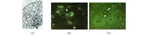 Time Lapse Cinemicrophotograph Of Lipid Laden Cells In The Presence Of