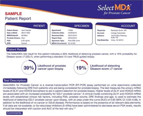 Select Mdx Test For Prostate Pc Markers Select Mdx Test For Prostate Pc Markers