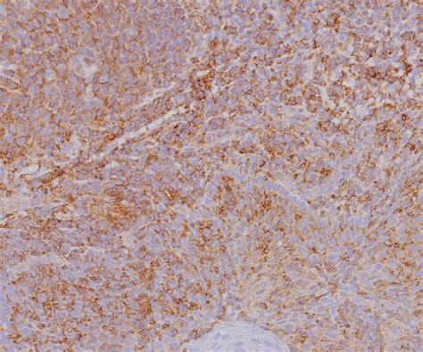 Hla Abc Antibody Mhc I8366r Nbp3 20580 Novus Biologicals