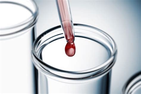 Taux de prothrombine à quoi il sert et valeurs de référence Tua Saúde