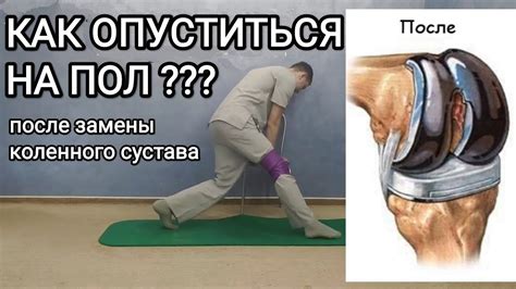 Как опуститься на пол после эндопротезирования коленного сустава