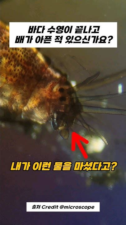 예 바닷가에 놀러 가면 배가 아픈 이유 Youtube
