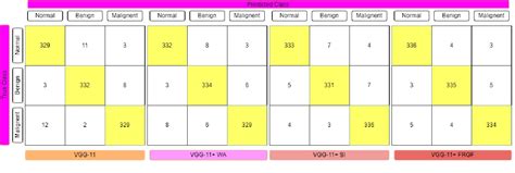 Figure 12 From Breast Cancer Detection In Mammography Images Using Deep Convolutional Neural