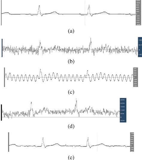 original ecg signal signal corrupted with different noises and