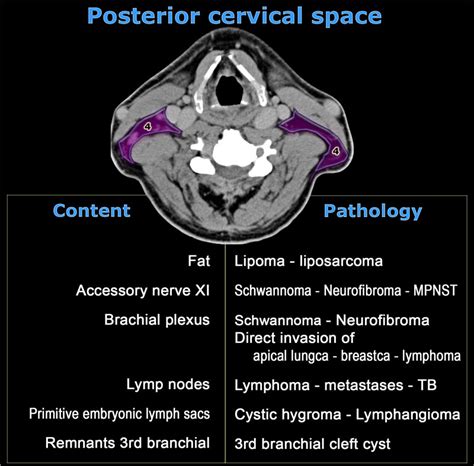 Ct Neck Levels Radiology At Pamela Ottley Blog