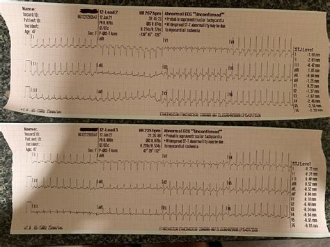 Case 8 Bay Plus Rdatahoarder