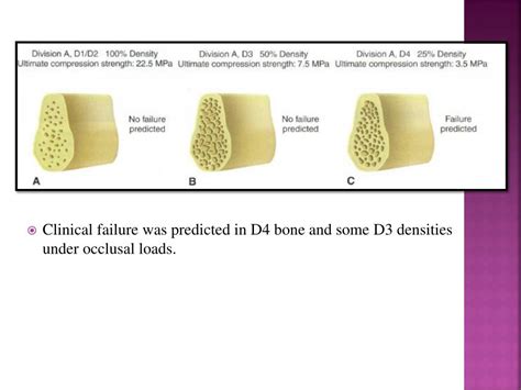Ppt Bone Density A Key Determinant For Treatment Planning
