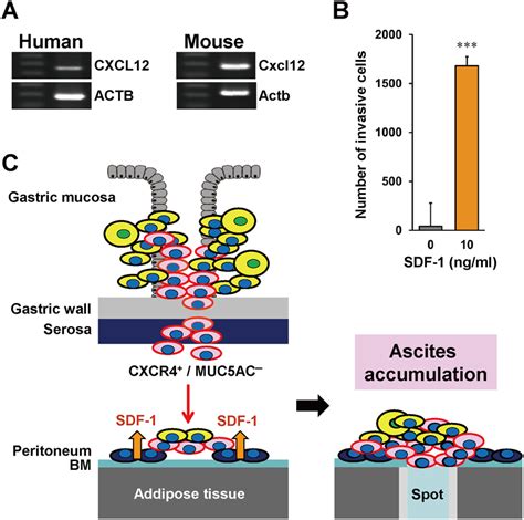Role Of Sdf 1 In Pd Of Diffuse Type Gc A Rt Pcr Of Cxcl12 In The