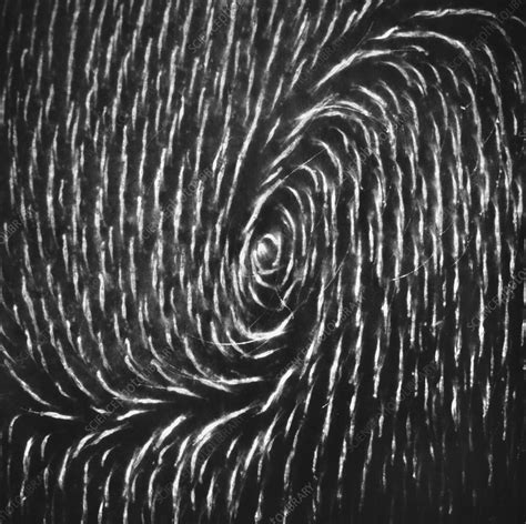 Lanugo Hair On Foetus Stock Image C0487803 Science Photo Library
