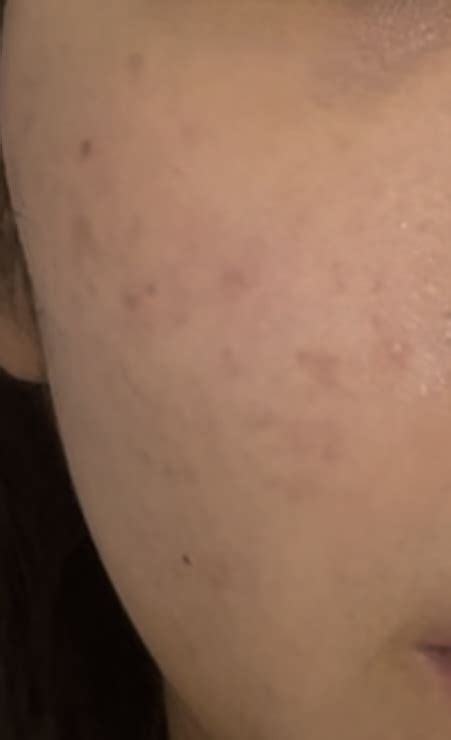 자유수다 도자기 피부 언냐들 강남언니 1등 성형수술and피부시술 정보앱