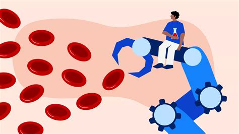 Reducing Human Error In The Coagulation Lab Lableaders
