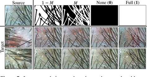 Figure 7 From Scalp Diagnostic System With Label Free Segmentation And