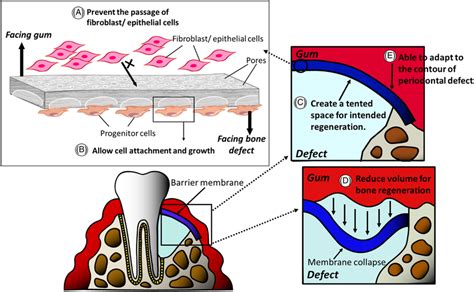 Barrier Membrane Technique At Joanne Magana Blog