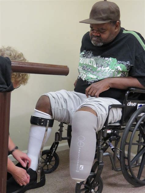 Image Gallery Prosthetic And Orthotic Services Arkansas