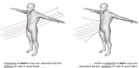 Rad Protection Lesson Radiation Absorption Flashcards Quizlet