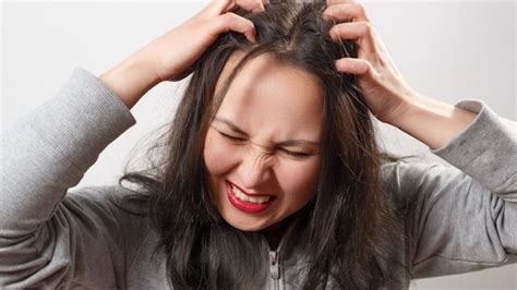 What Is The Difference Between Dandruff And Dry Scalp Buildup Onlymyhealth