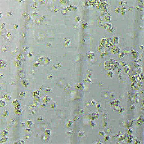 Blood Cell Detection V Object Detection Dataset And Pre Trained Model