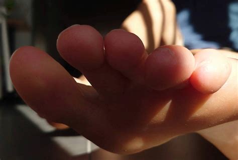 Toes By Blotevoetendroom On Deviantart