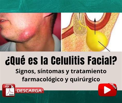 Celulitis Facial Cómo Eliminar La Celulitis De La Cara Doctor Online