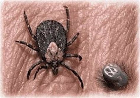 Algunas Picaduras De Garrapatas Pueden Provocar La Enfermedad De Lyme